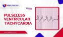 Pulseless Ventricular Tachycardia: A Guide for Patients