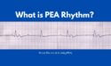 What Is PEA Rhythm? Causes, ECG Signs & ACLS Guide