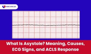 Asystole Meaning: Causes, ECG Signs, and ACLS Response Guide